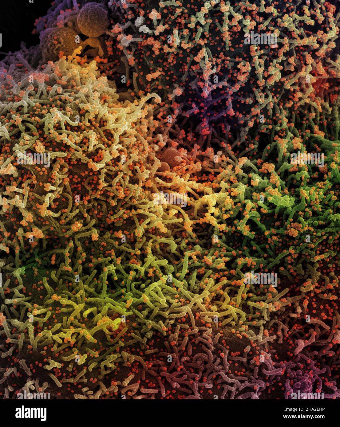Scanning electron micrograph of a cell infected with a variant strain ...