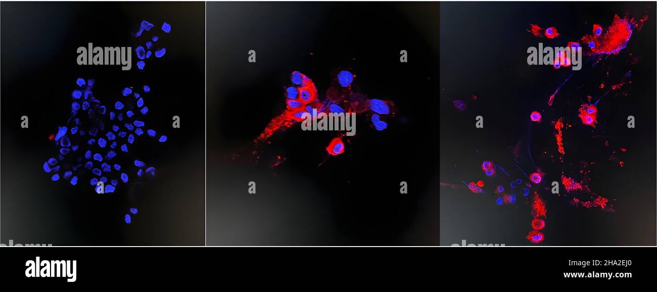 Fluorochrome hi-res stock photography and images - Alamy