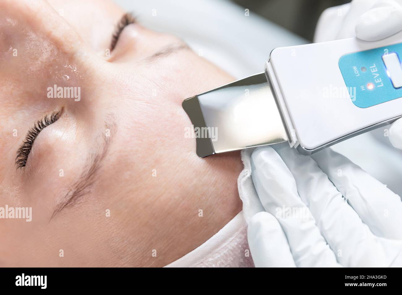 Ultrasound peel hi-res stock photography and images - Alamy