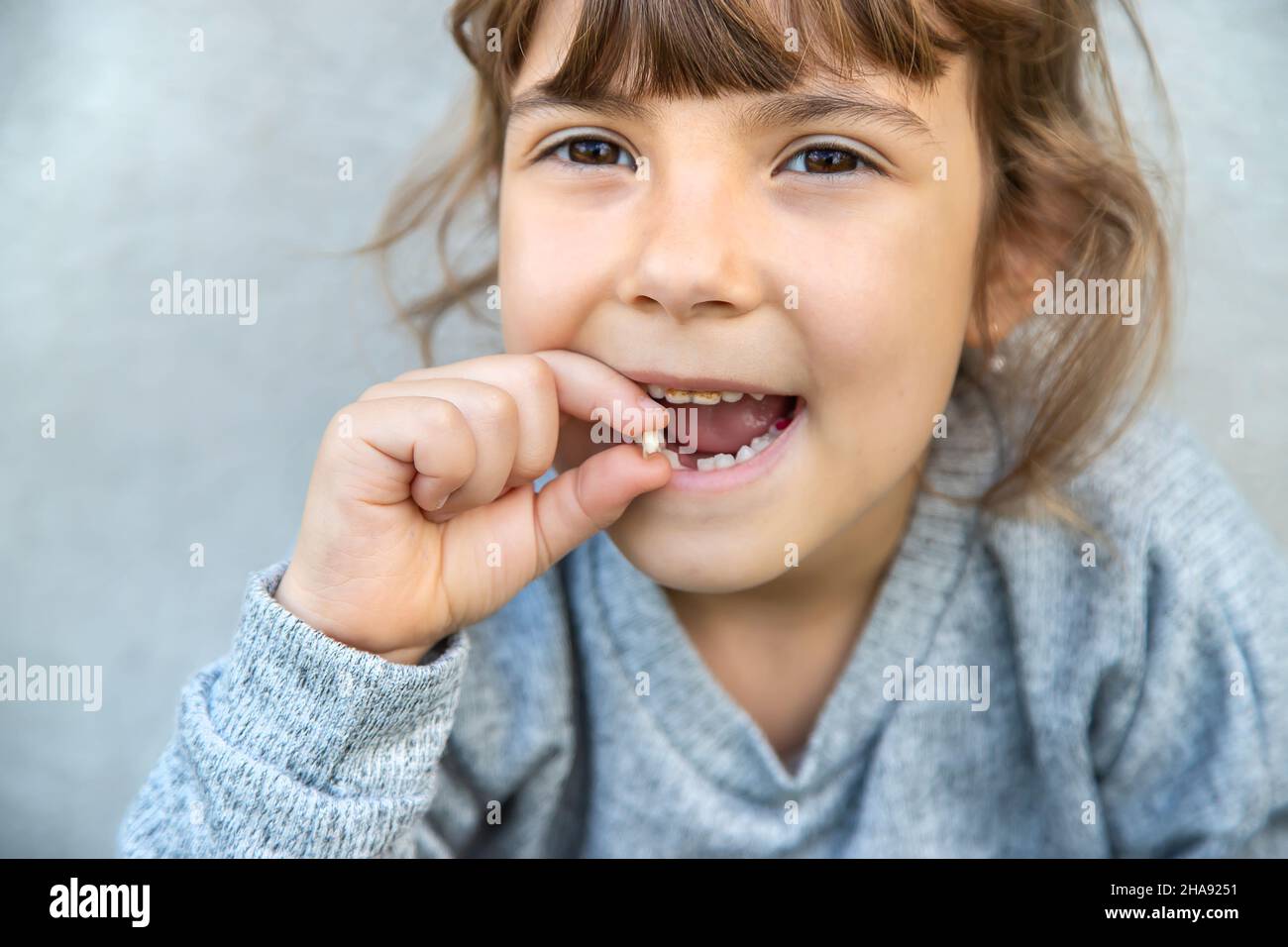 Baby tooth fell out hi-res stock photography and images - Alamy