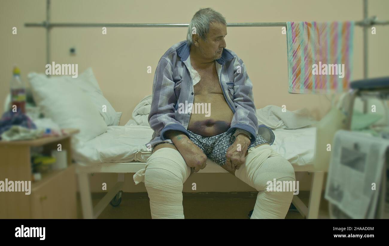 The patient is 72 years old. Extensive polyarthritis. Surgery hip ...