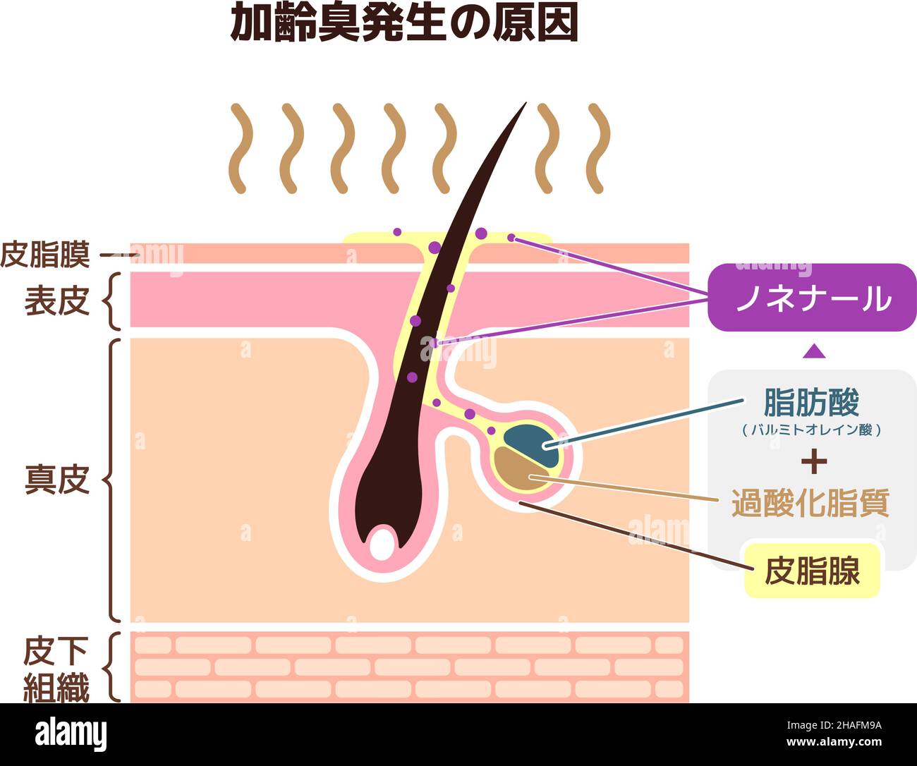 Causes of aging odors vector illustration Stock Vector Image & Art - Alamy