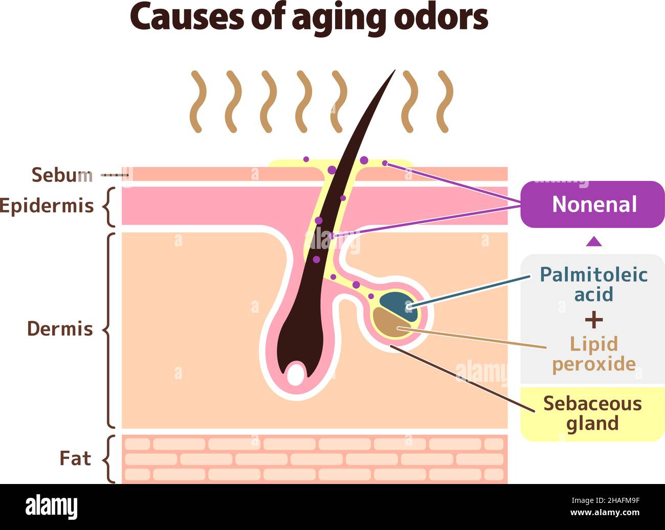 Causes of aging odors vector illustration Stock Vector Image & Art - Alamy