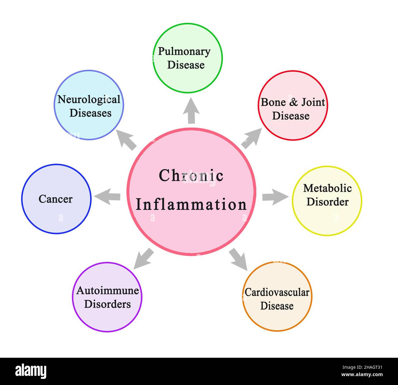 Seven Consequences of Chronic Inflammation Stock Photo - Alamy