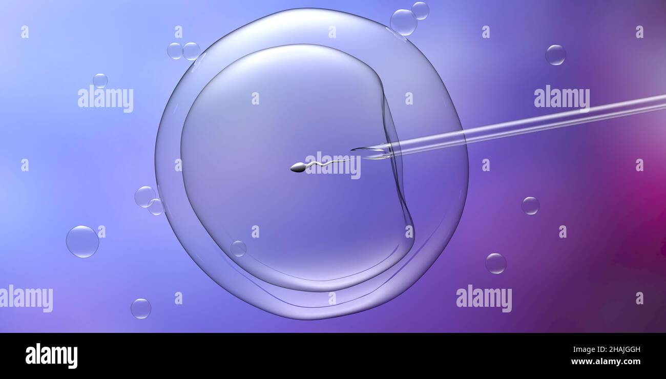 IVF, Artificial insemination, in vitro fertilization on microscope ...