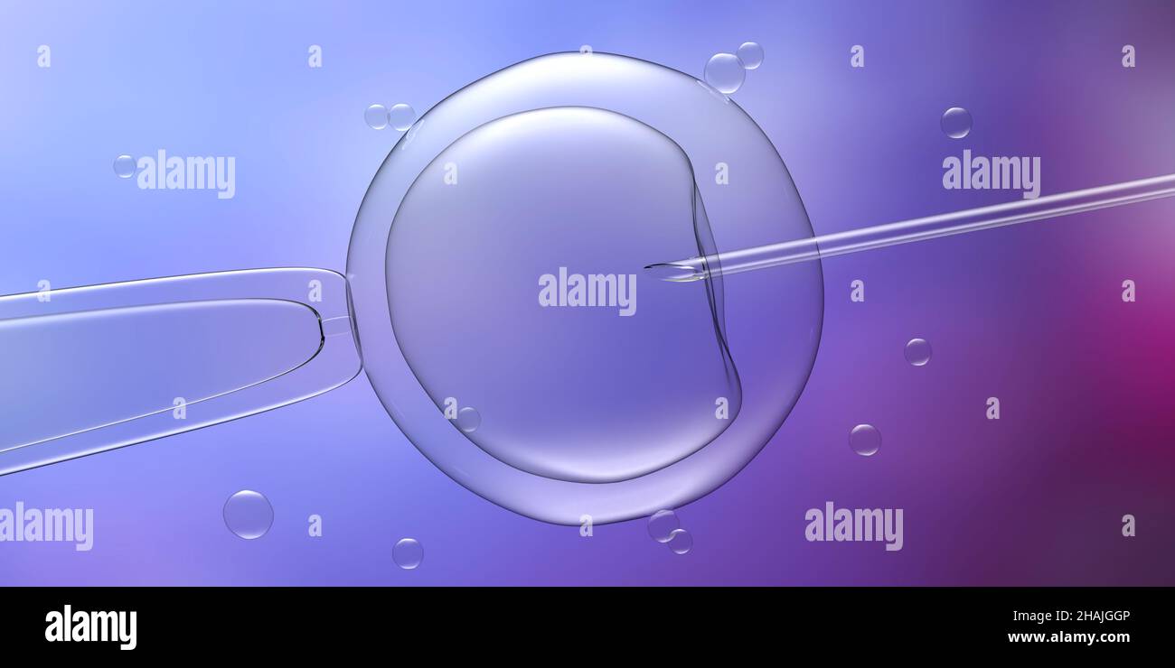 Artificial insemination, in vitro fertilization, IVF fertility on ...