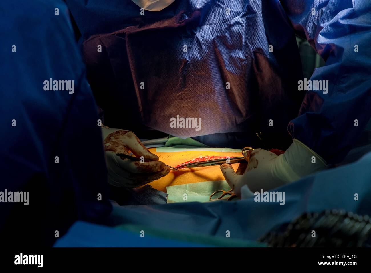 Operating room cutting legs for internal intervention Stock Photo - Alamy