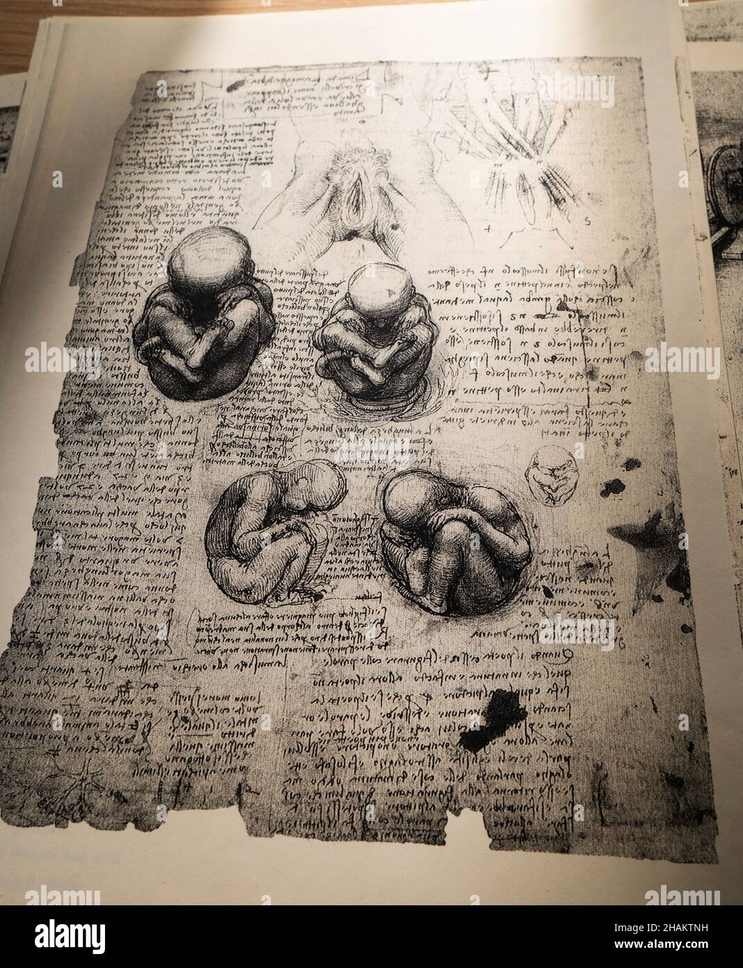 Kandy, Sri Lanka - 17 February 2021: 14th century anatomy art by ...