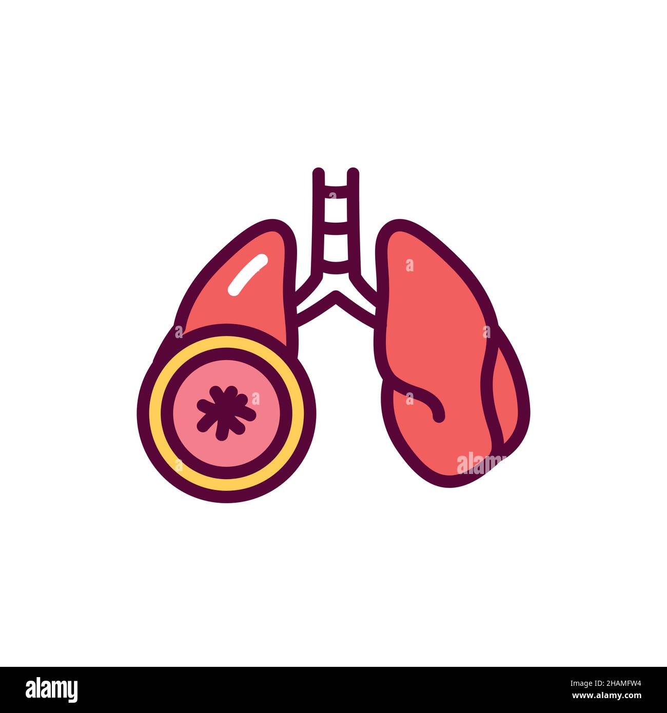 Bronchitis drawing hi-res stock photography and images - Alamy