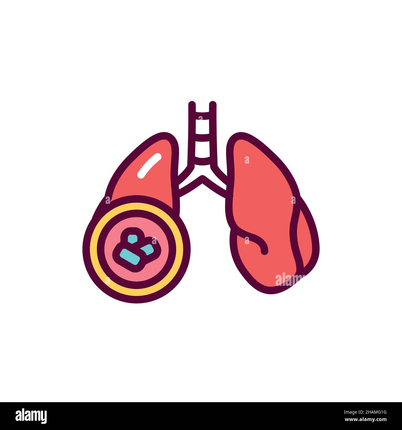 Tuberculosis color line icon. Isolated vector element. Outline ...