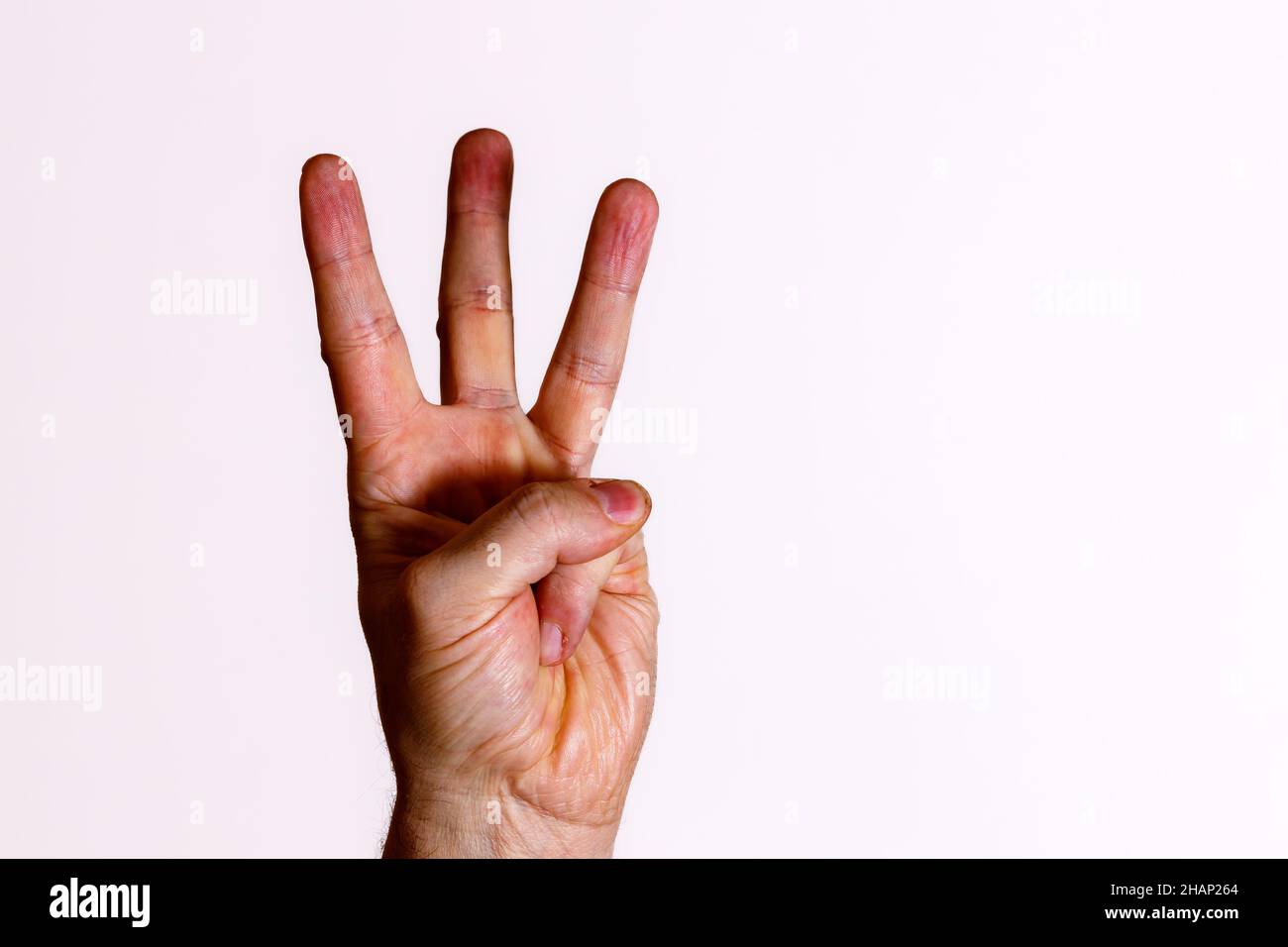 A hand with 3 finger Stock Photo - Alamy