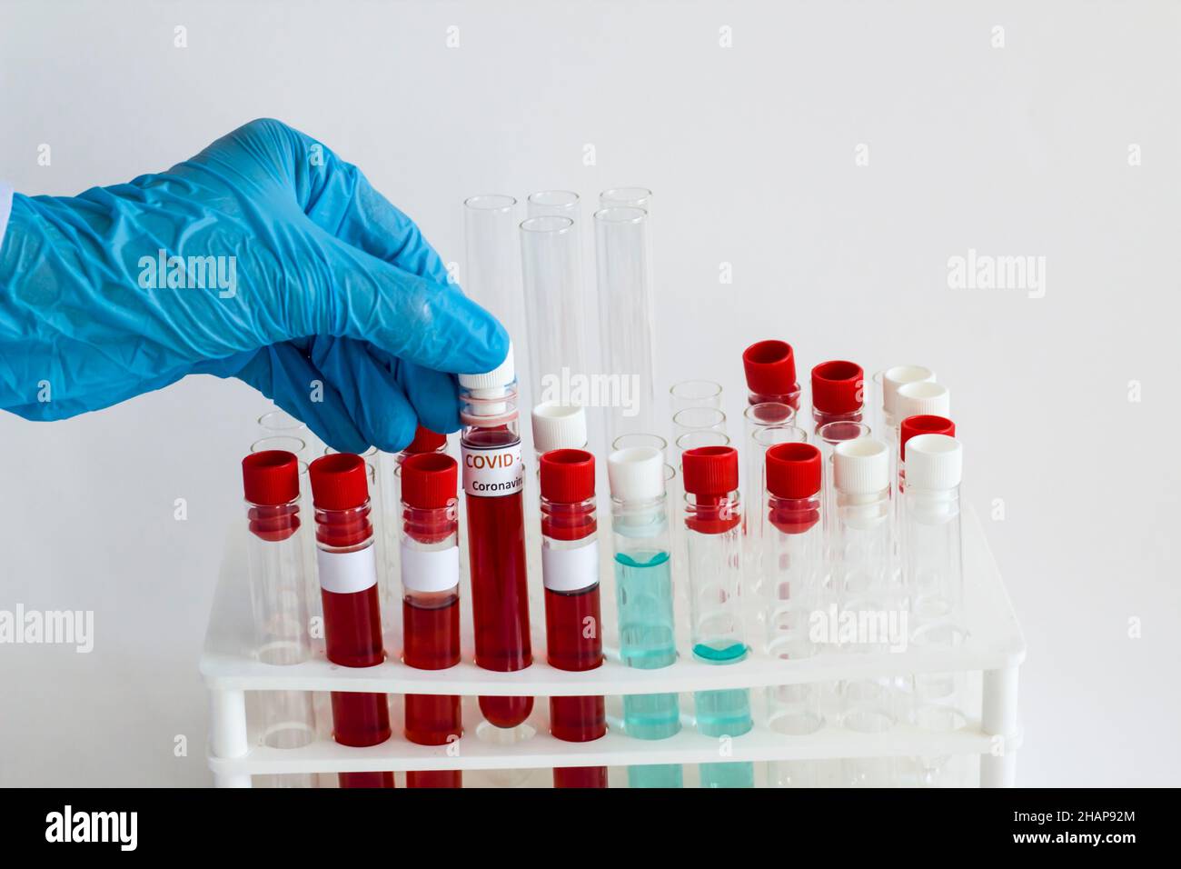Blue gloved hand checking glass blood tubes Stock Photo - Alamy