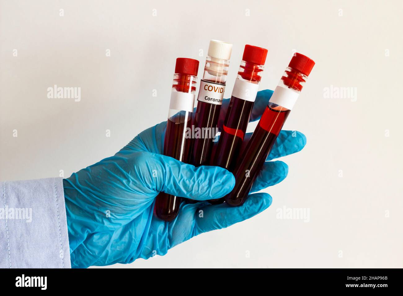 Four blood tubes hi-res stock photography and images - Alamy