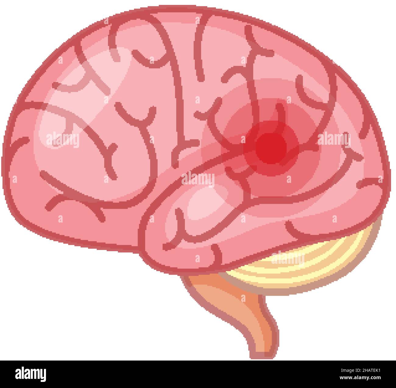 The brain has a red signal on white background illustration Stock ...
