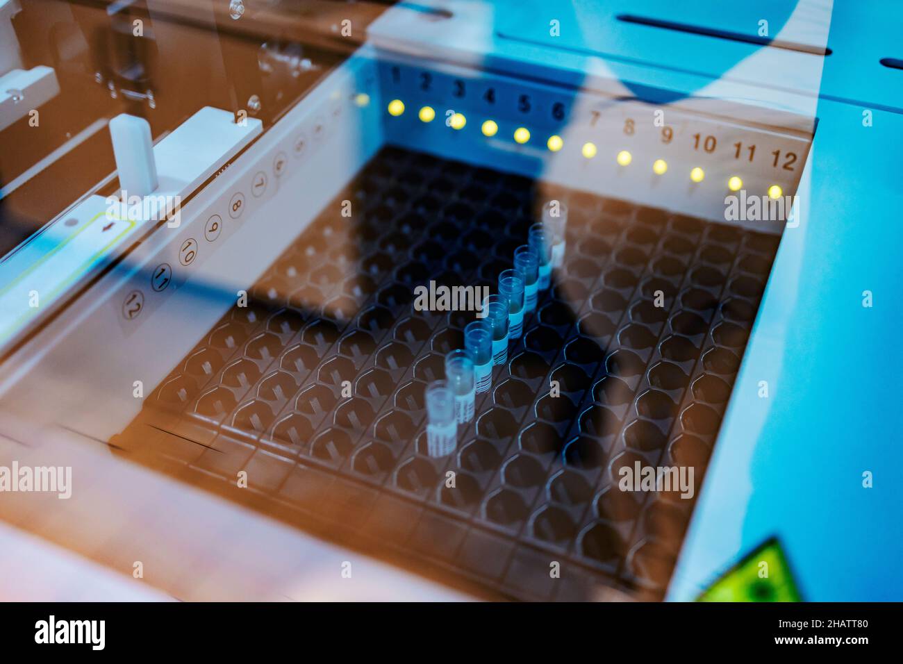 Blood sample storage machine. Close up of blood samples in test tubes ...