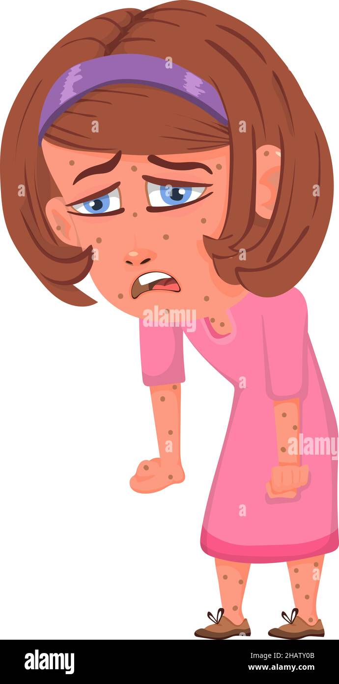Girl with chickenpox. Ill kid with rush and measles. Sick child Stock ...