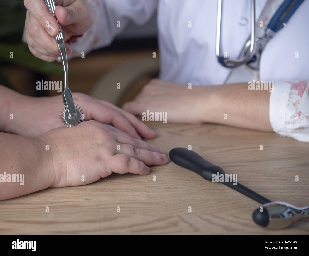 The doctor checks the pain sensitivity with the Wartenberg wheel on the ...