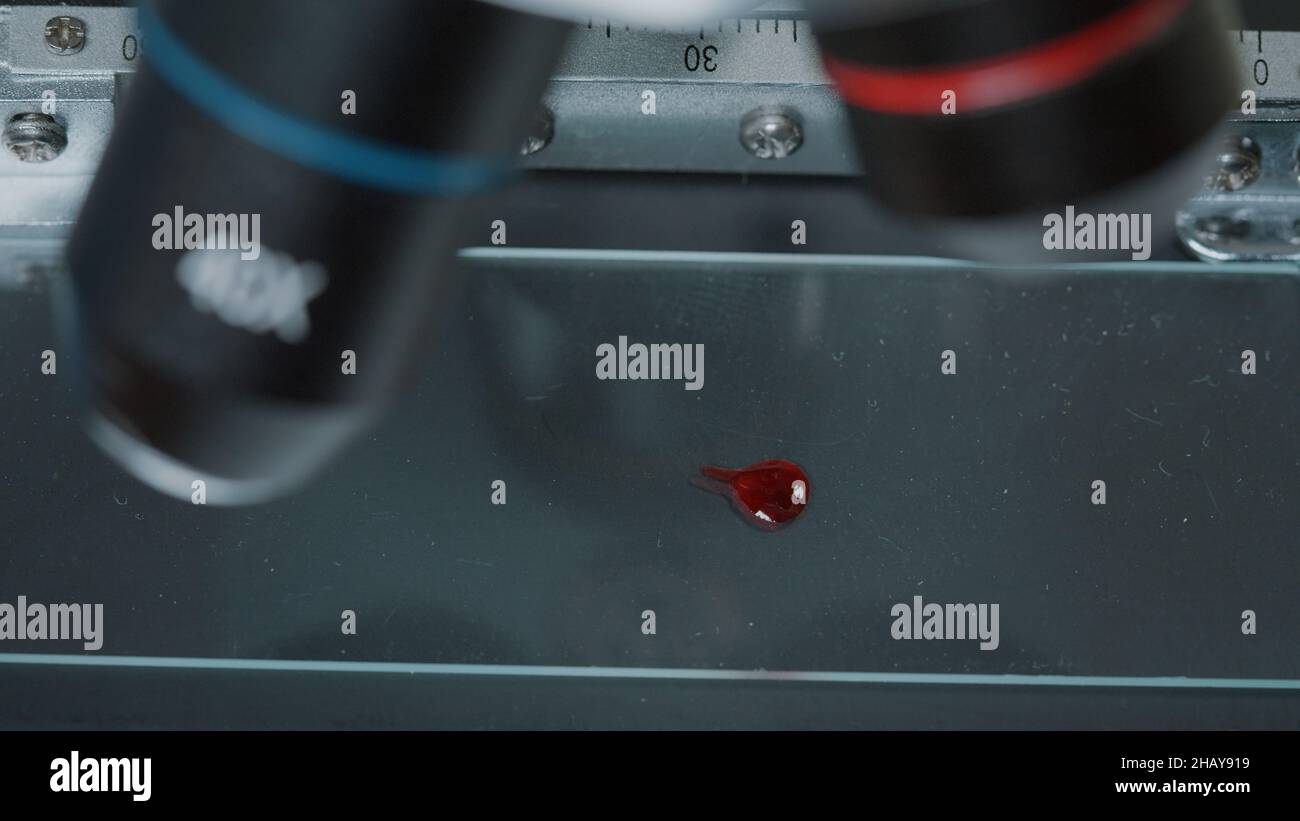 Micro pipette putting blood sample on microscope to test dna and ...