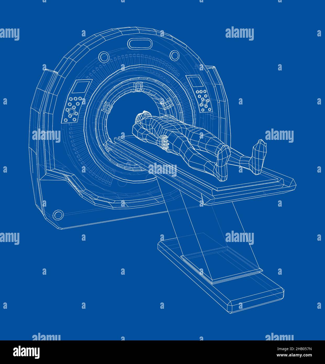MRI machine scanning patient inside Stock Photo - Alamy