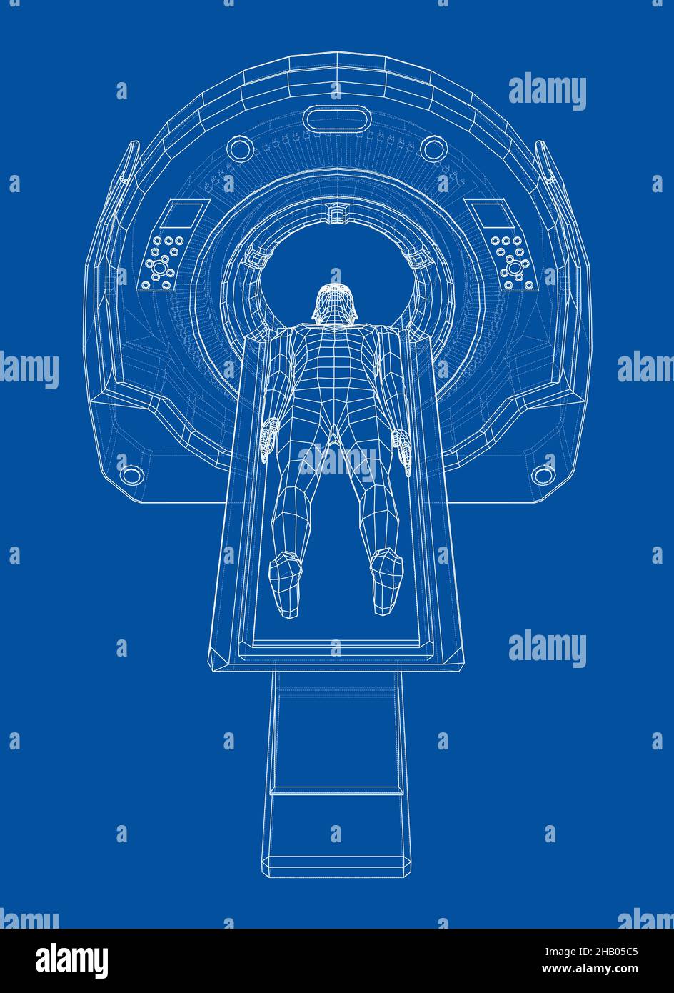MRI machine scanning patient inside Stock Photo - Alamy