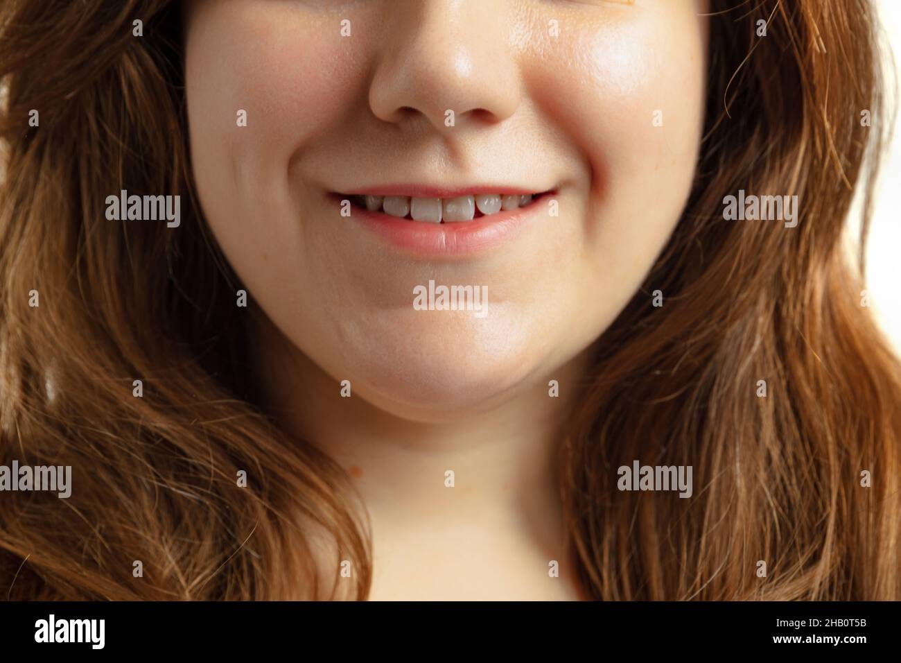 Girl without teeth smiling hi-res stock photography and images - Alamy