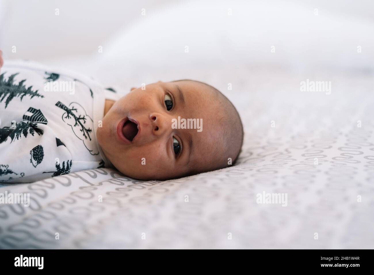 Bald kid hi-res stock photography and images - Alamy