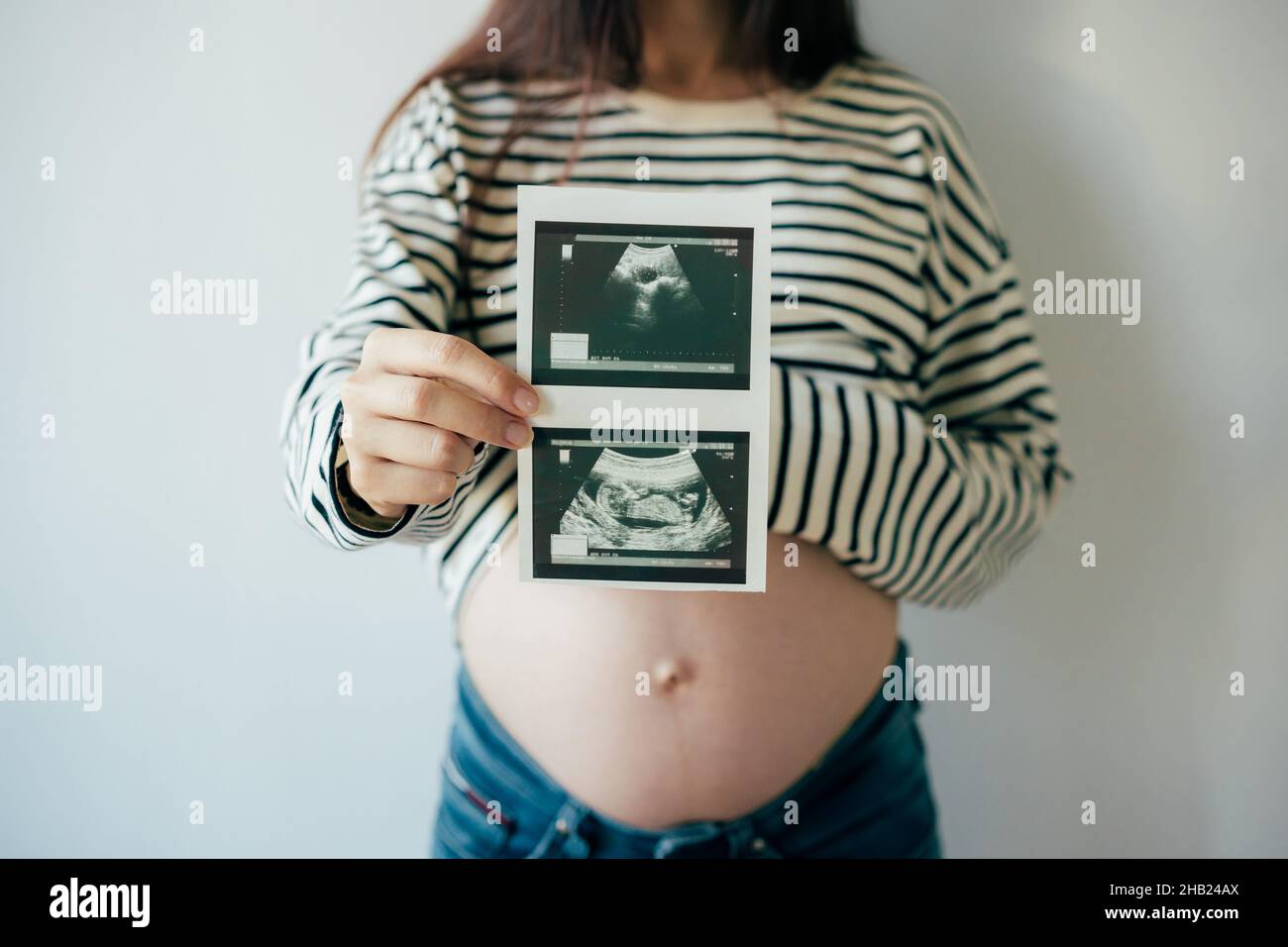 A pregnant woman is holding an ultrasound scan of an expected baby ...