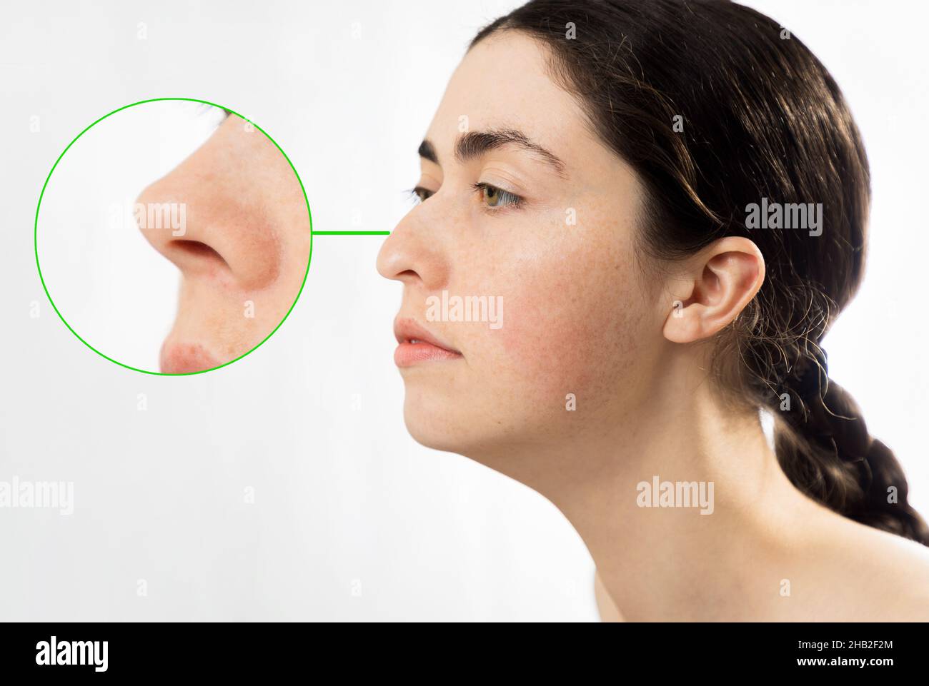 Portrait of young caucasian woman showing her crooked nose and zoom ...