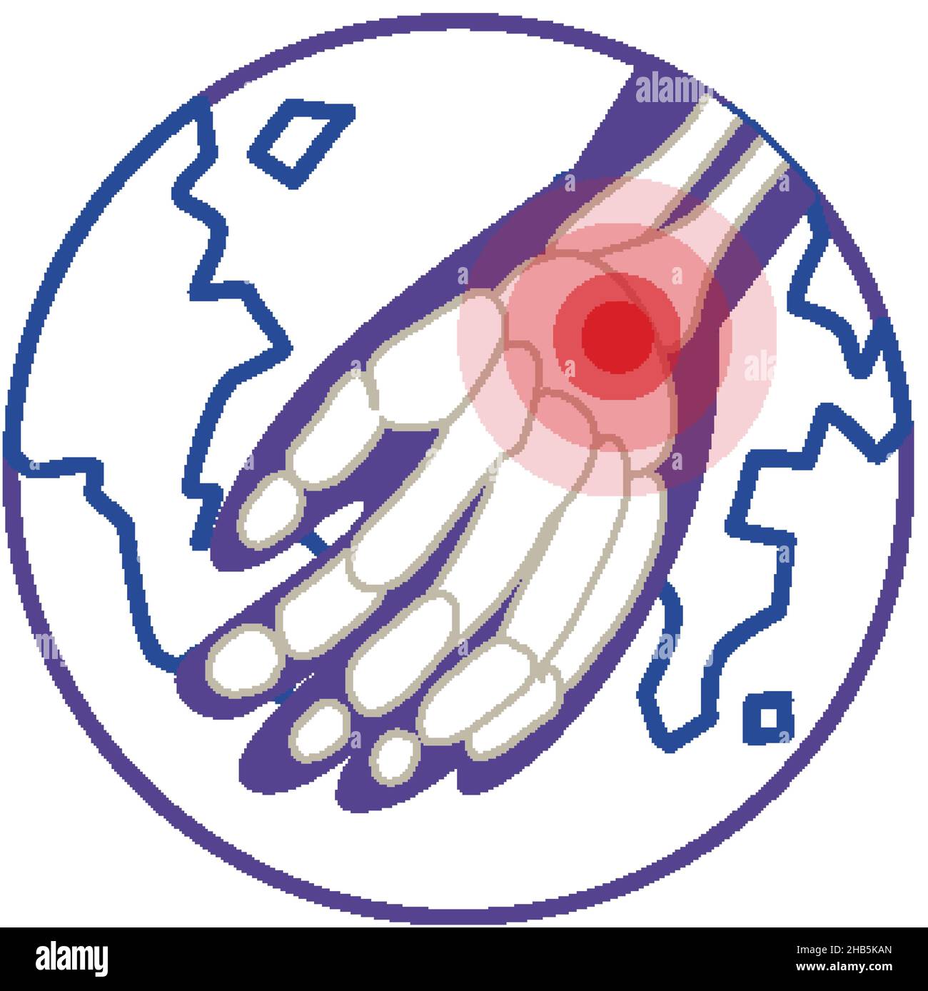 Hand joint with a pain or injury illustration Stock Vector Image & Art ...