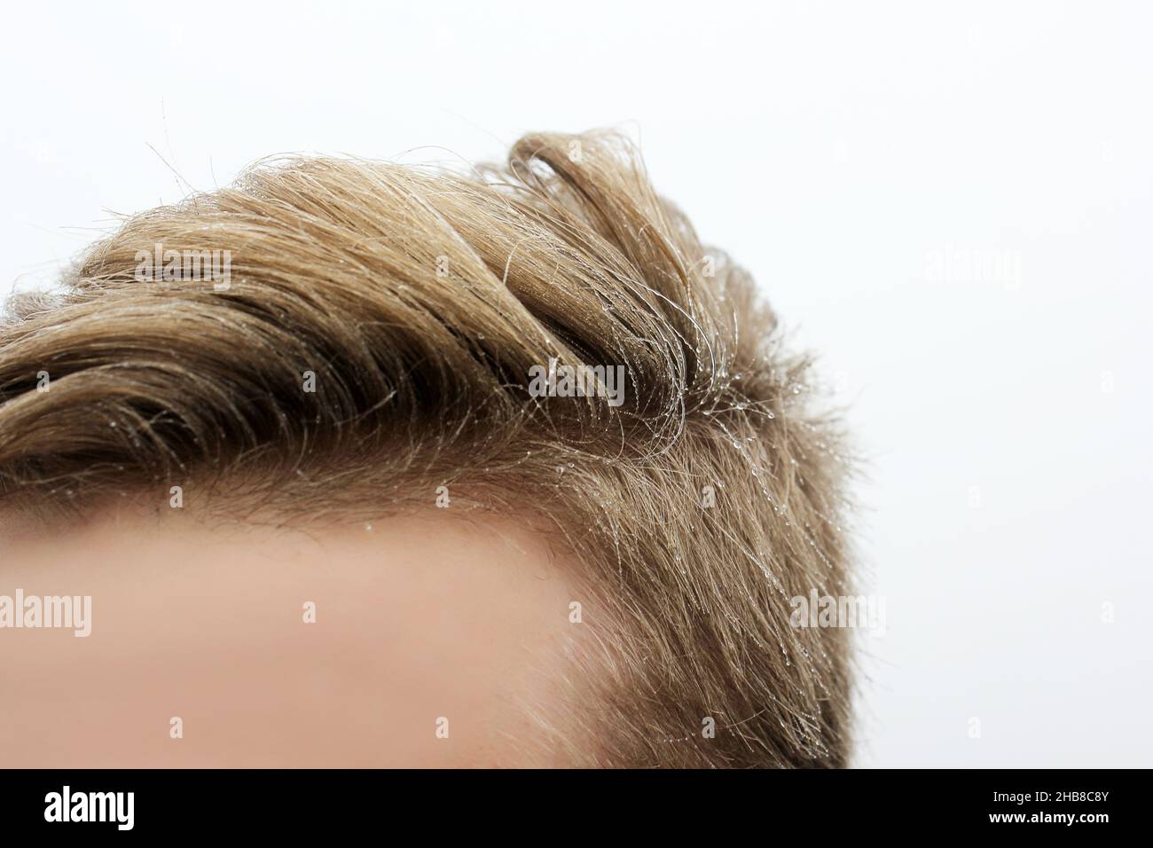 Hair in raindrops Stock Photo - Alamy