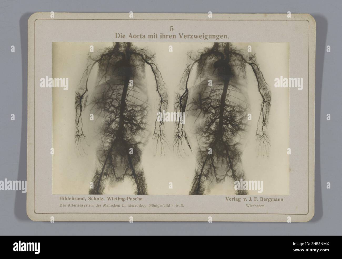 Die aorta hi-res stock photography and images - Alamy