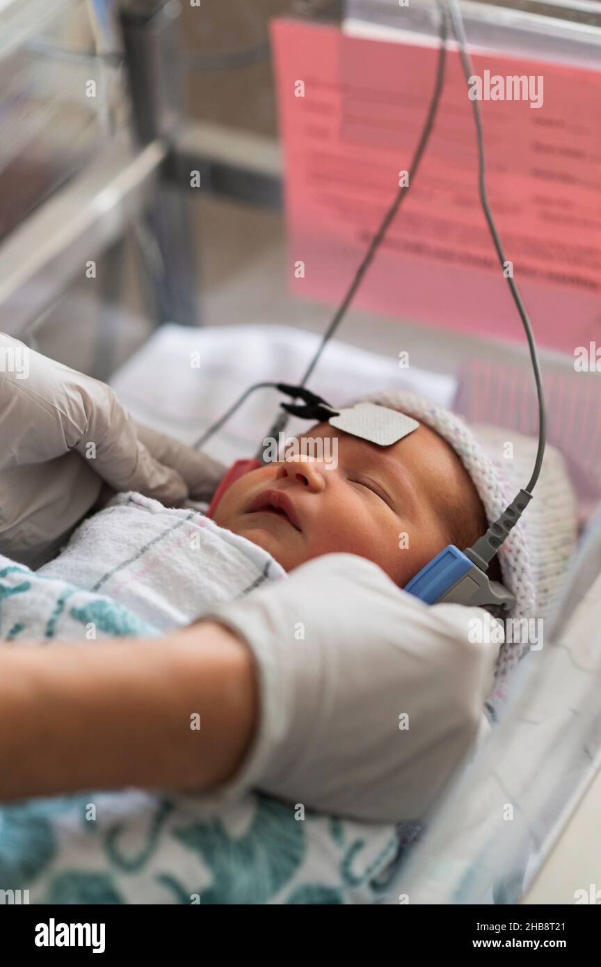 Auditory brainstem response hi-res stock photography and images - Alamy