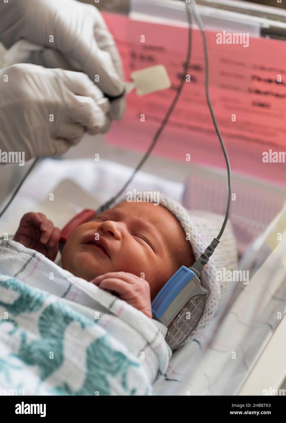 Auditory brainstem hi-res stock photography and images - Alamy