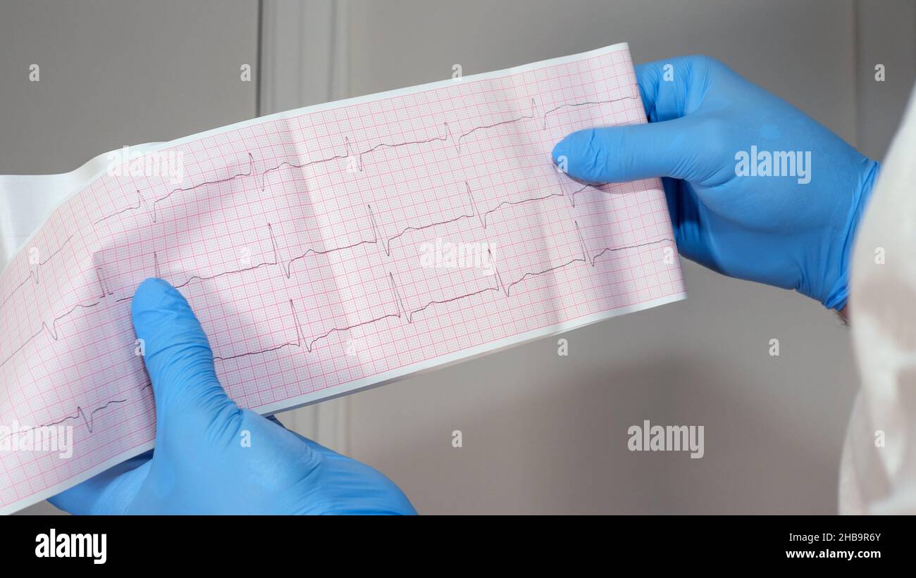 Heart cardiogram in the hands of a doctor. Doctor analyzes heart ...