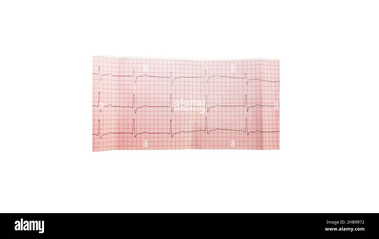 Heart cardiogram in the hands of a doctor. Doctor analyzes heart ...