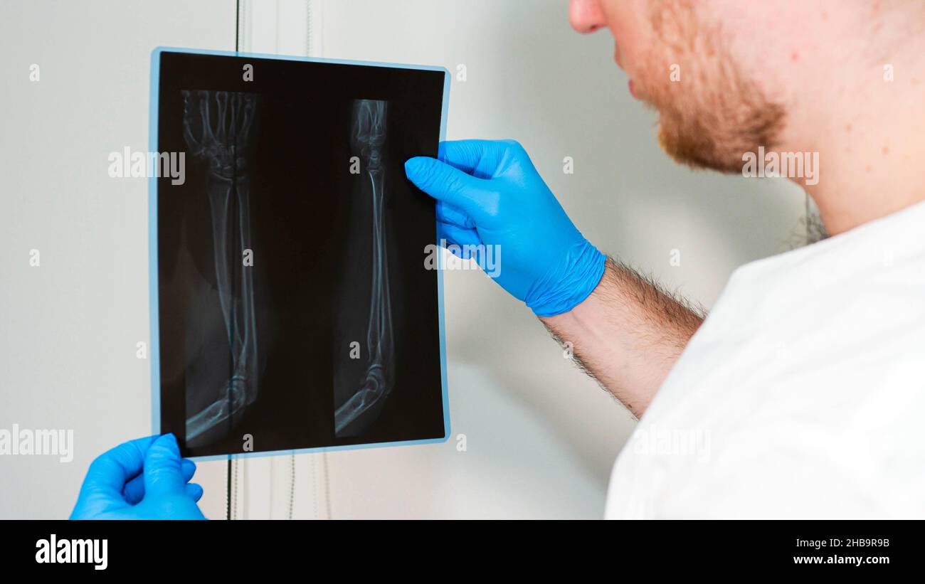 X-ray injury to the right forearm, A male doctor examines the injury to ...