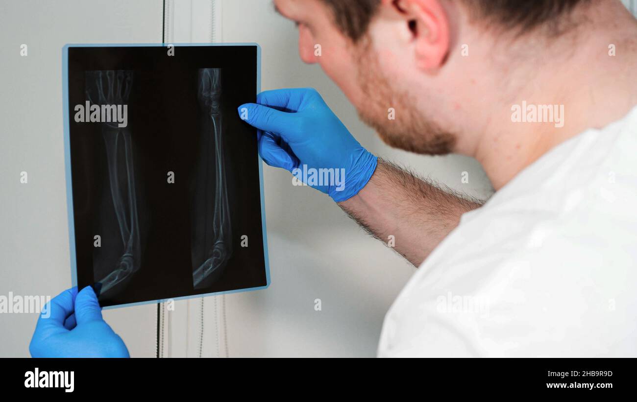 X-ray injury to the right forearm, A male doctor examines the injury to ...