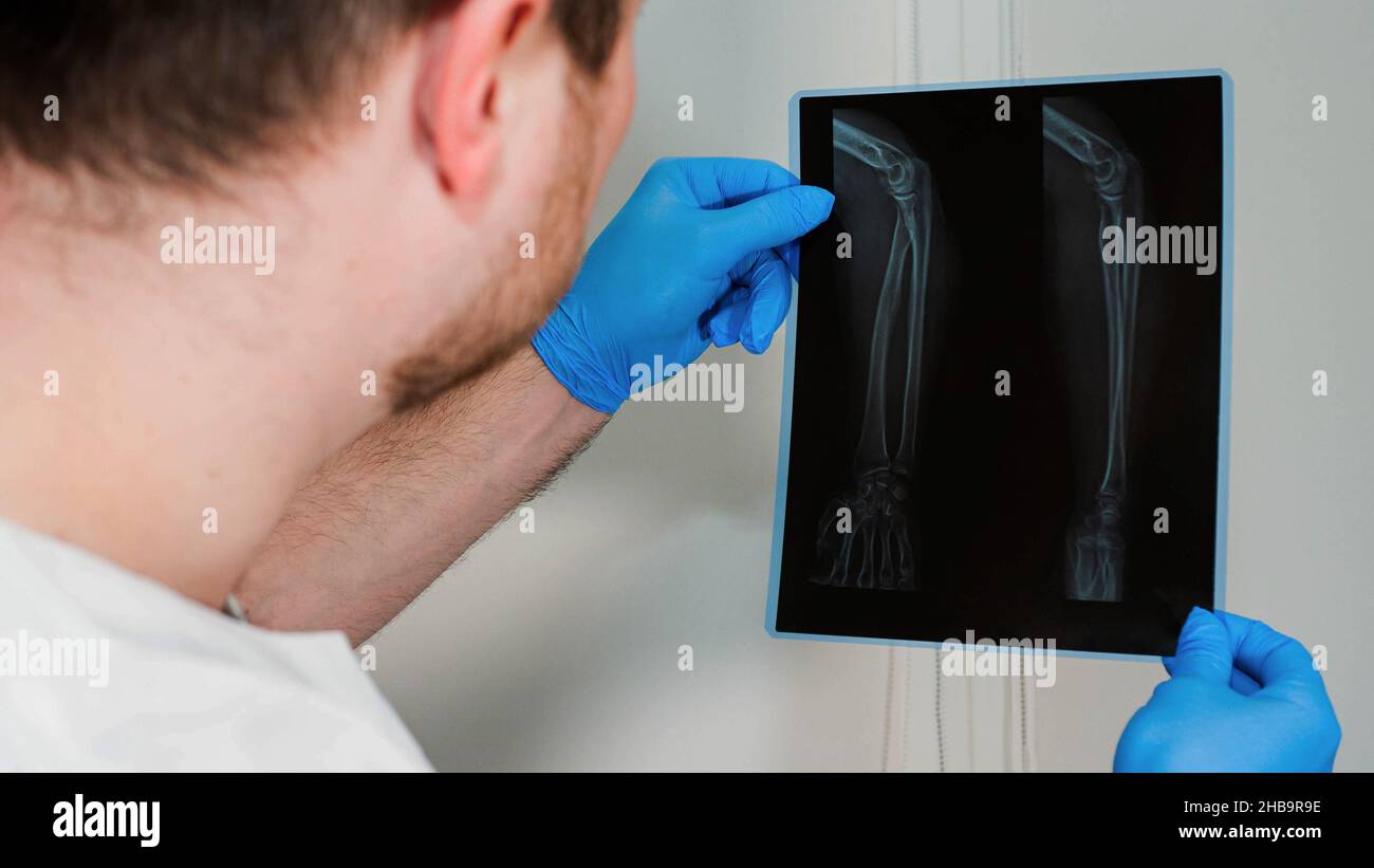 X-ray injury to the right forearm, A male doctor examines the injury to ...