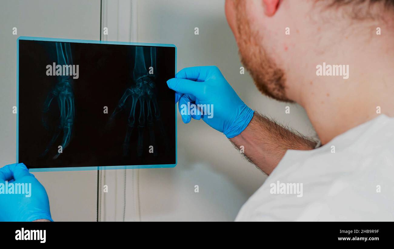 X-ray injury of the wrist. A male doctor carefully examines a hand ...