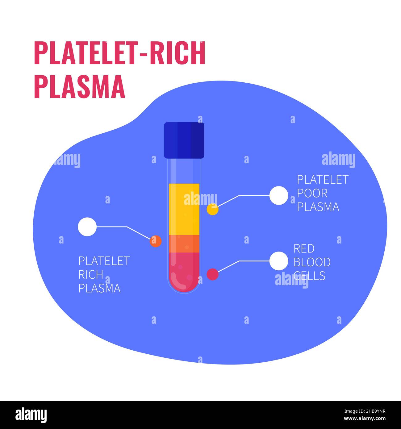 Platelet-rich plasma composition, conceptual illustration Stock Photo ...
