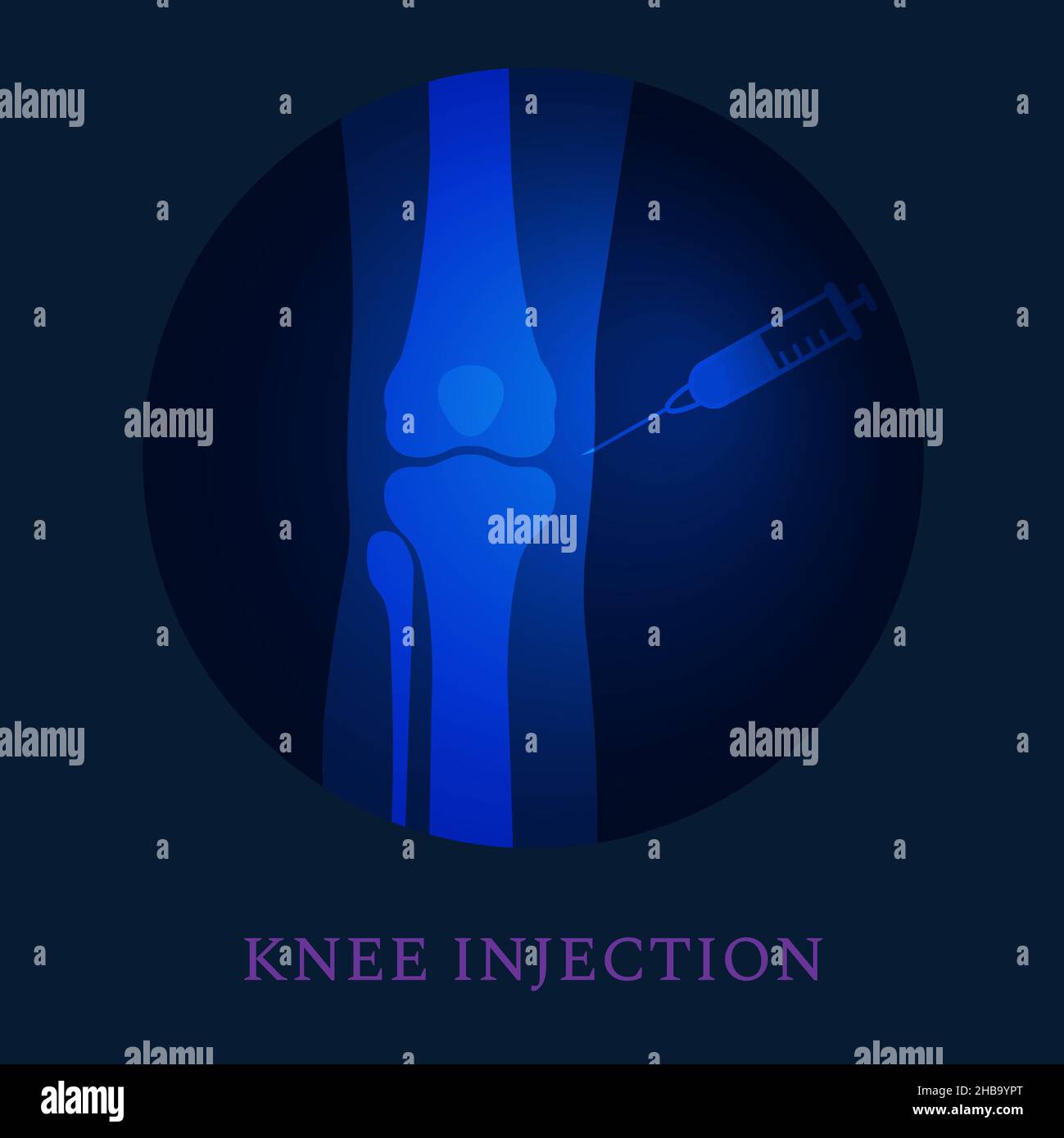Knee joint injection treatment, conceptual illustration Stock Photo - Alamy