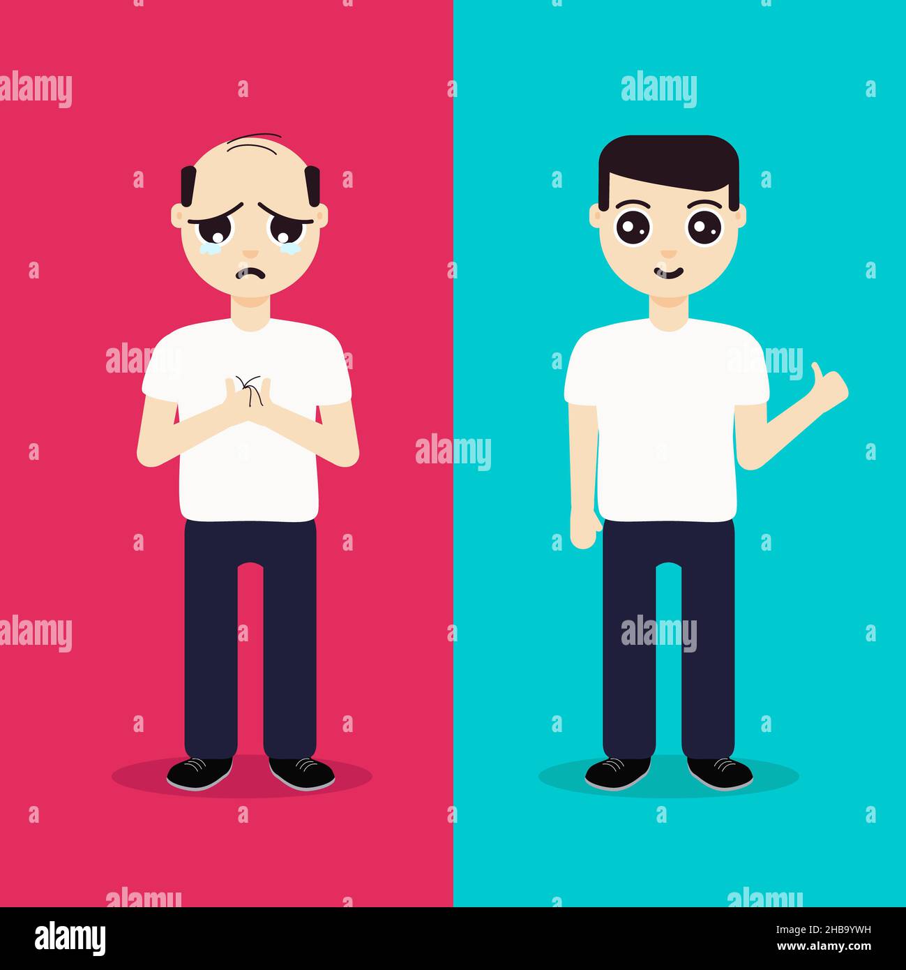 Man before and after hair regeneration, illustration Stock Photo - Alamy