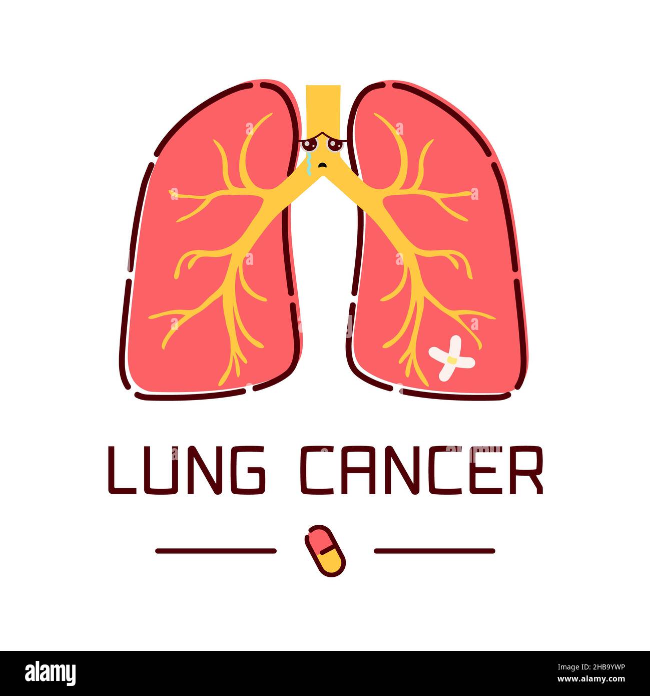 Lung cancer, conceptual illustration Stock Photo - Alamy