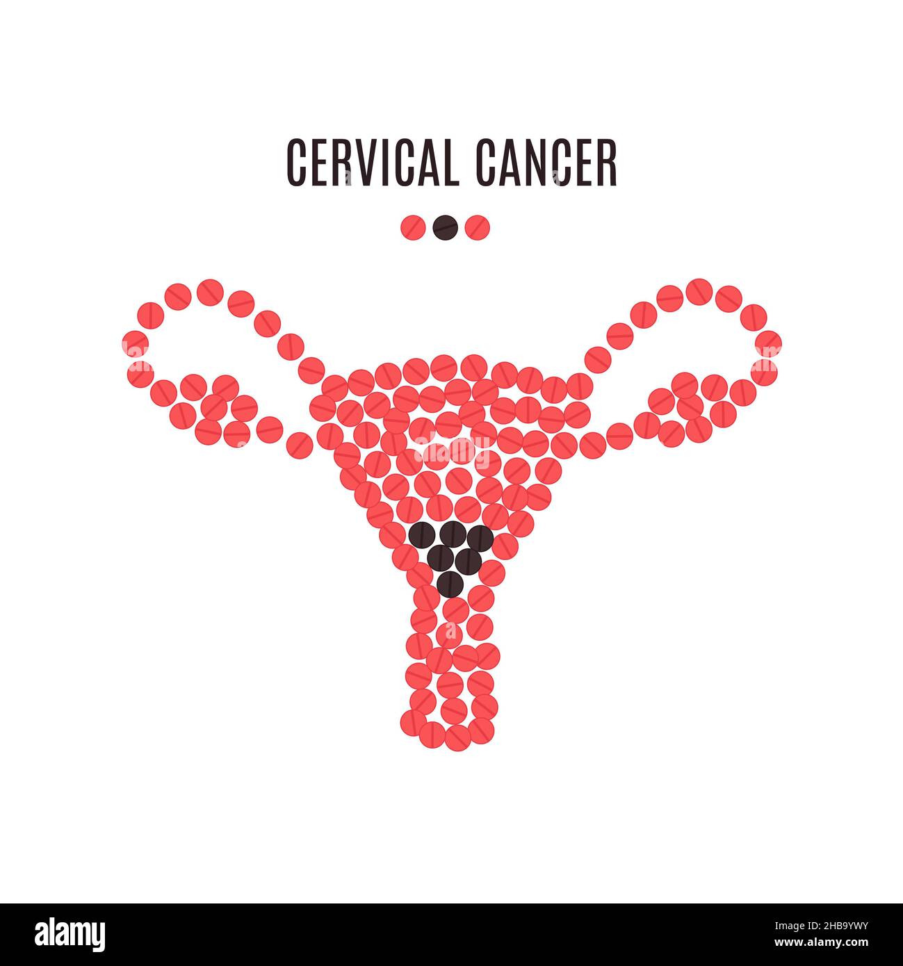 Cervical cancer, conceptual illustration Stock Photo - Alamy