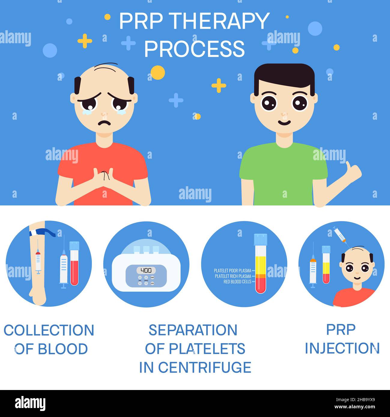 Plasma rich protein (PRP), illustration Stock Photo - Alamy