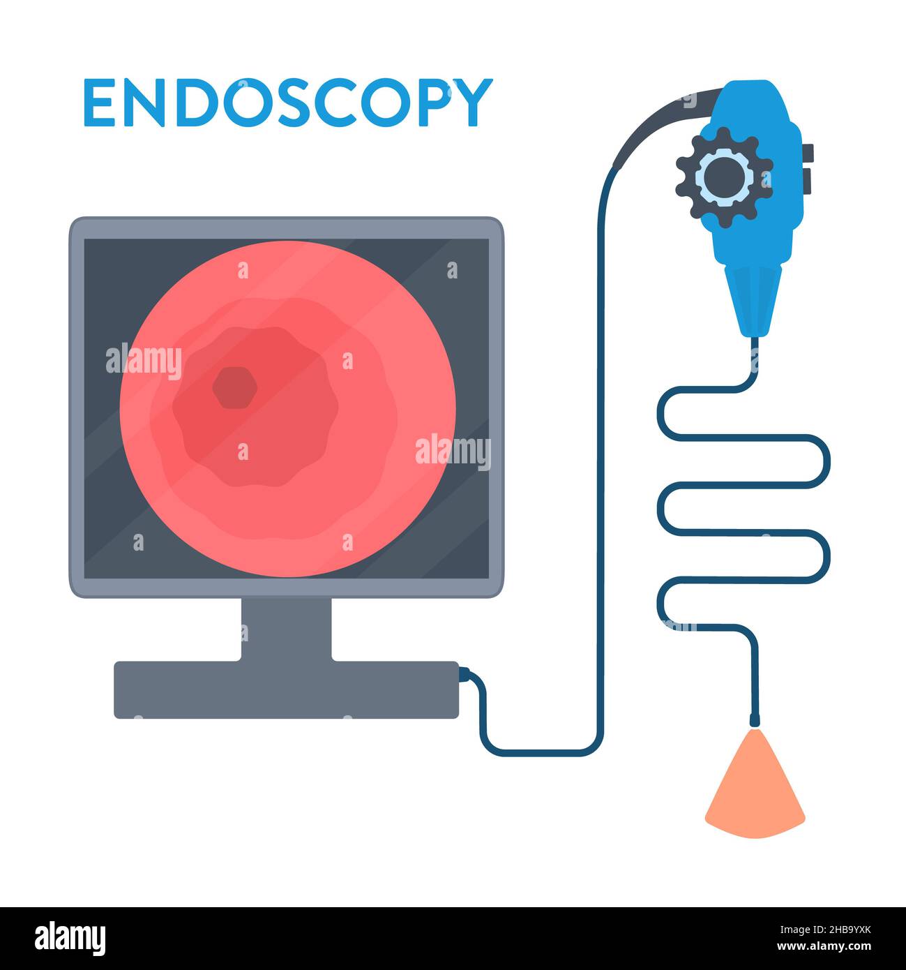 Endoscopy esophagus hi-res stock photography and images - Alamy