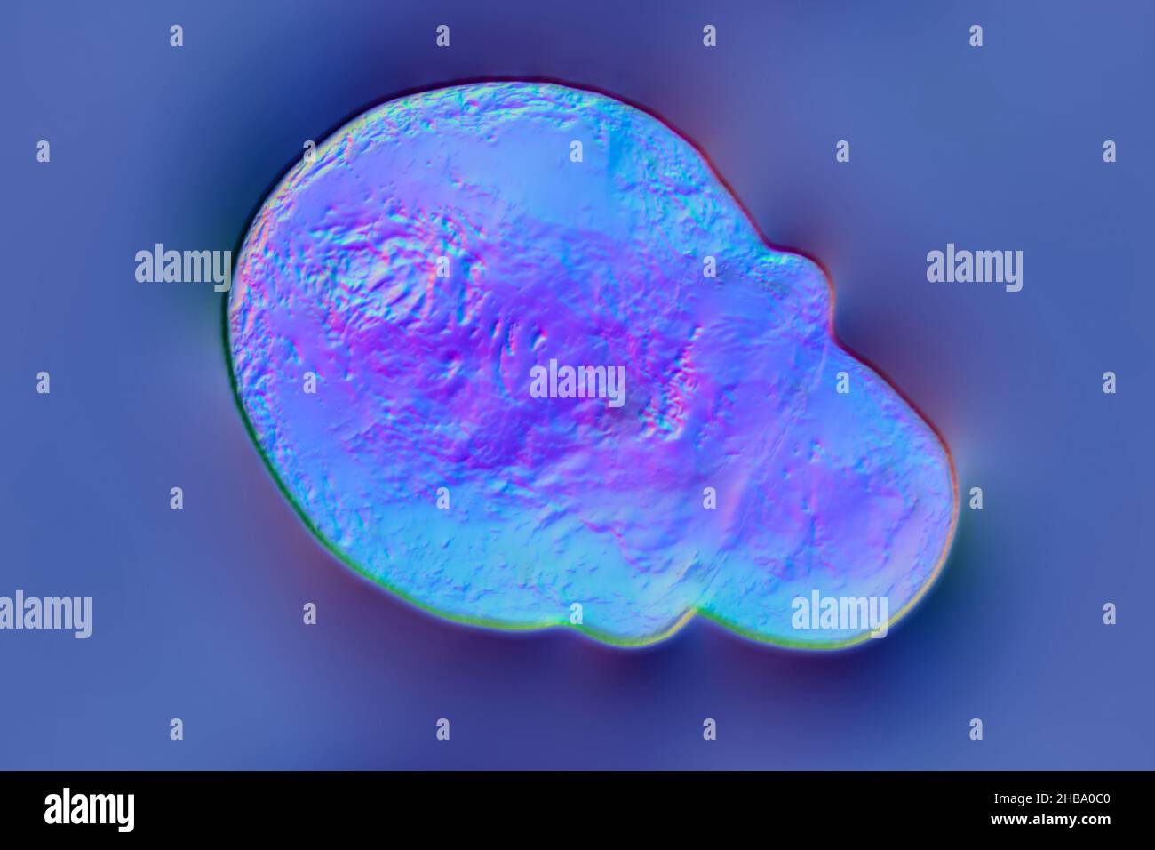 Tinea flava hi-res stock photography and images - Alamy