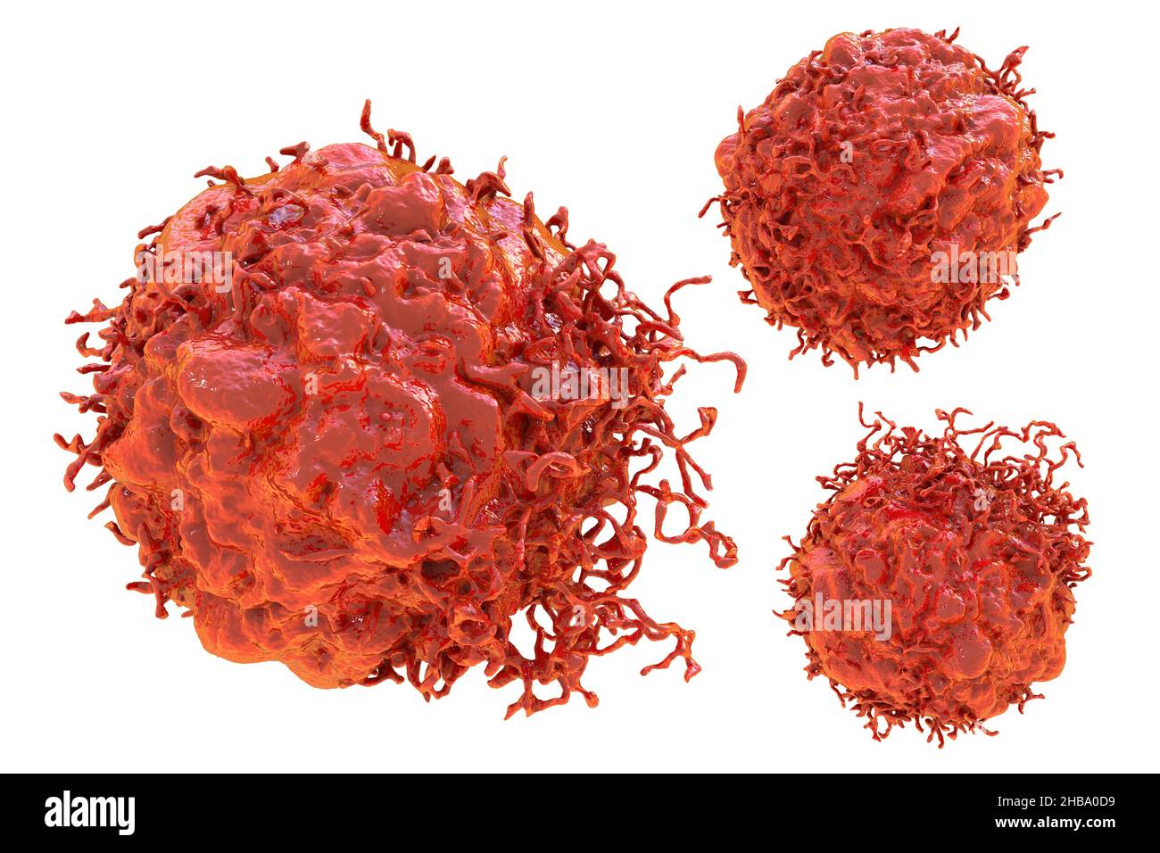 Cancer cells, illustration Stock Photo - Alamy