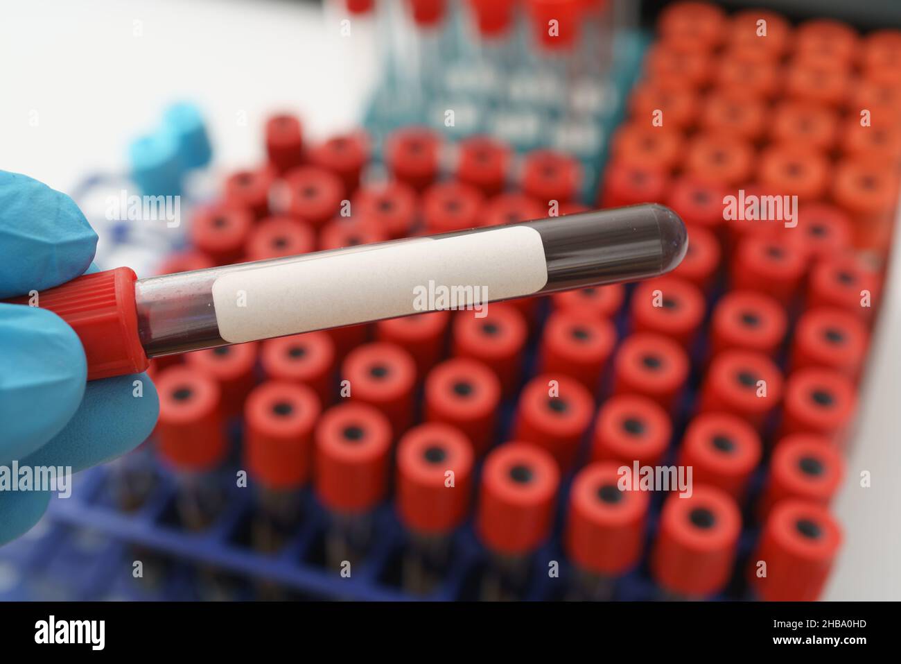 Test tube with a blood sample and empty label Stock Photo - Alamy