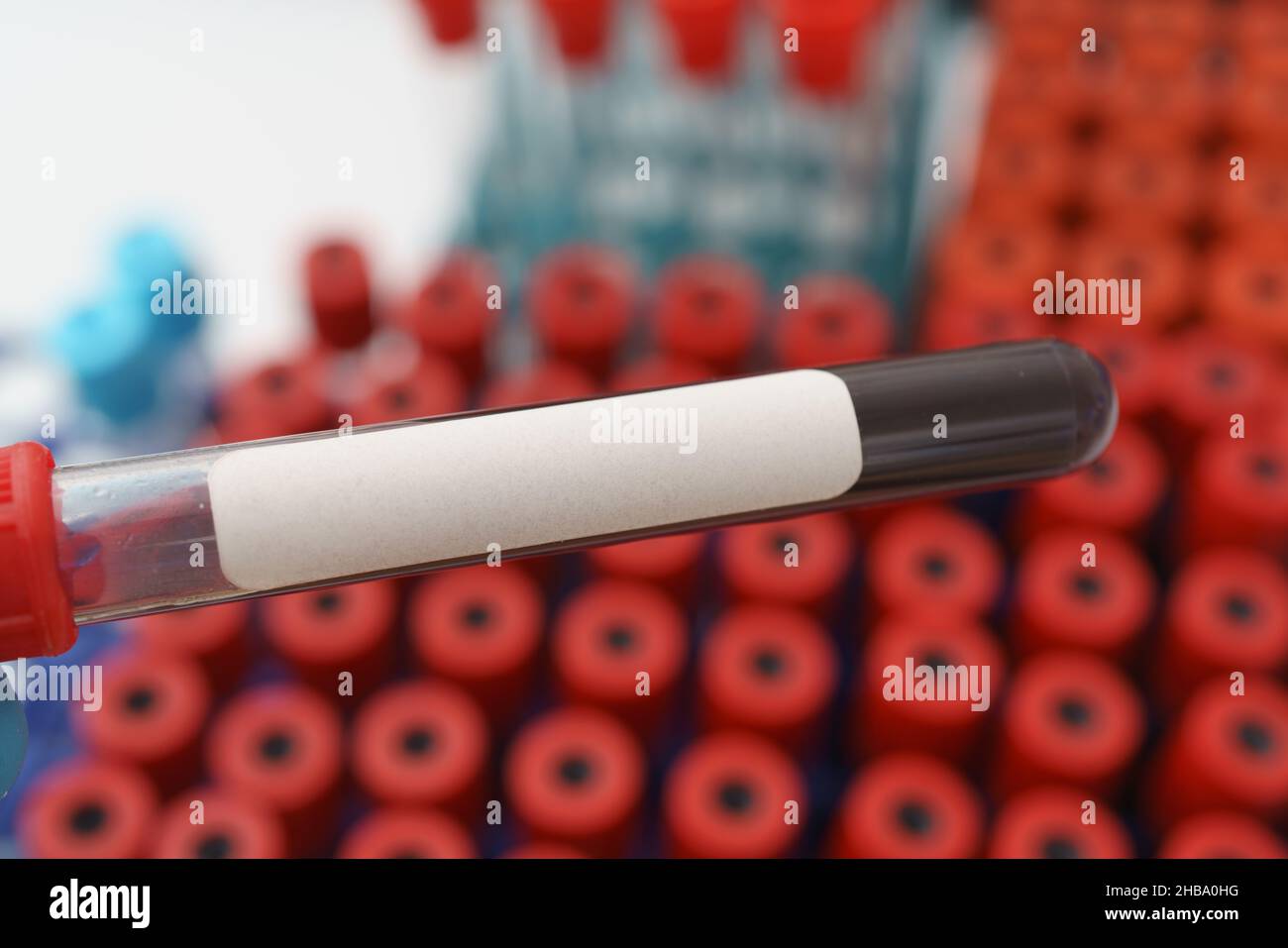 Test tube with a blood sample and empty label Stock Photo - Alamy